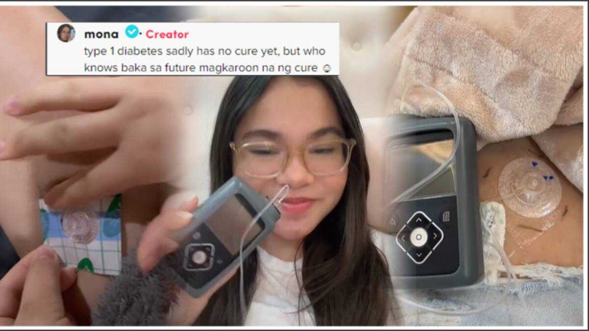 Mona Alawi, pinakita kung paano niya inaayos ang kanyang insulin pump site - KAMI.COM.PH