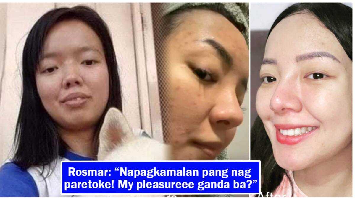 Rosmar Tan, ibinida din ang kanyang version ng "before and after ...