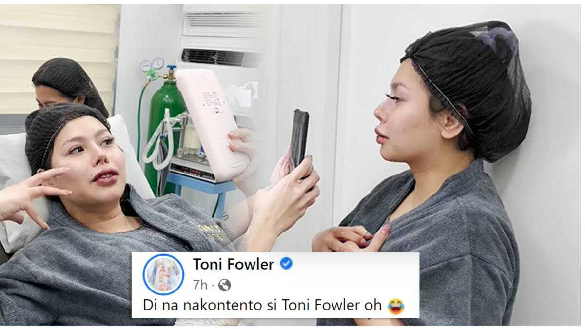 Toni Fowler, muling sumailalim sa panibagong lip enhancement - KAMI.COM.PH