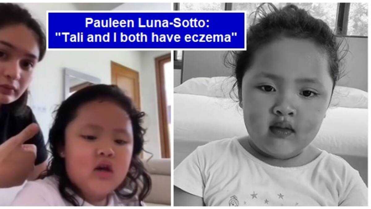 Get well soon: Tali Sotto at Pauleen Luna, nagkaroon ng eczema - KAMI ...