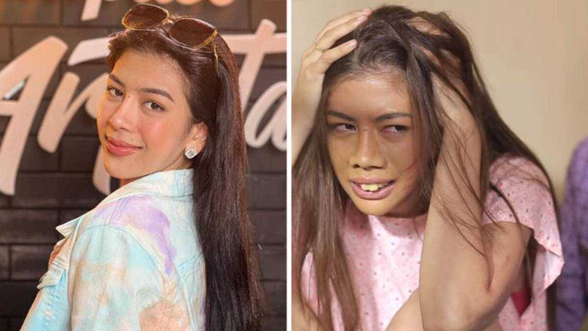 Herlene Budol, nagkasugat sa eksena sa "Magandang Dilag": "Hindi ko napansin kasi nag-eenjoy ...