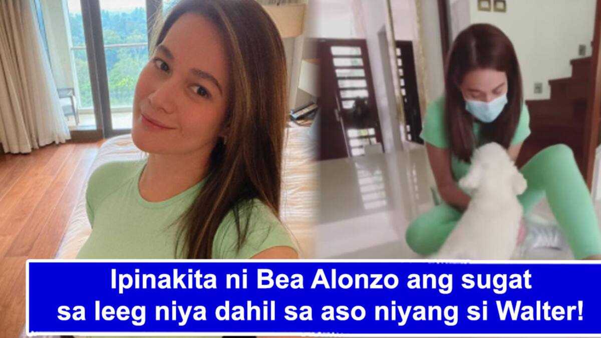 Bea Alonzo, ipinakita ang na-scratch ng aso niya sa leeg niya: "Miss na ...