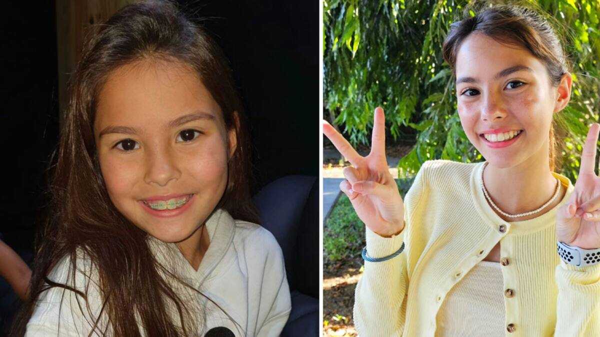 Kendra Kramer, sobrang saya at tinanggal na braces niya: “I can eat ...