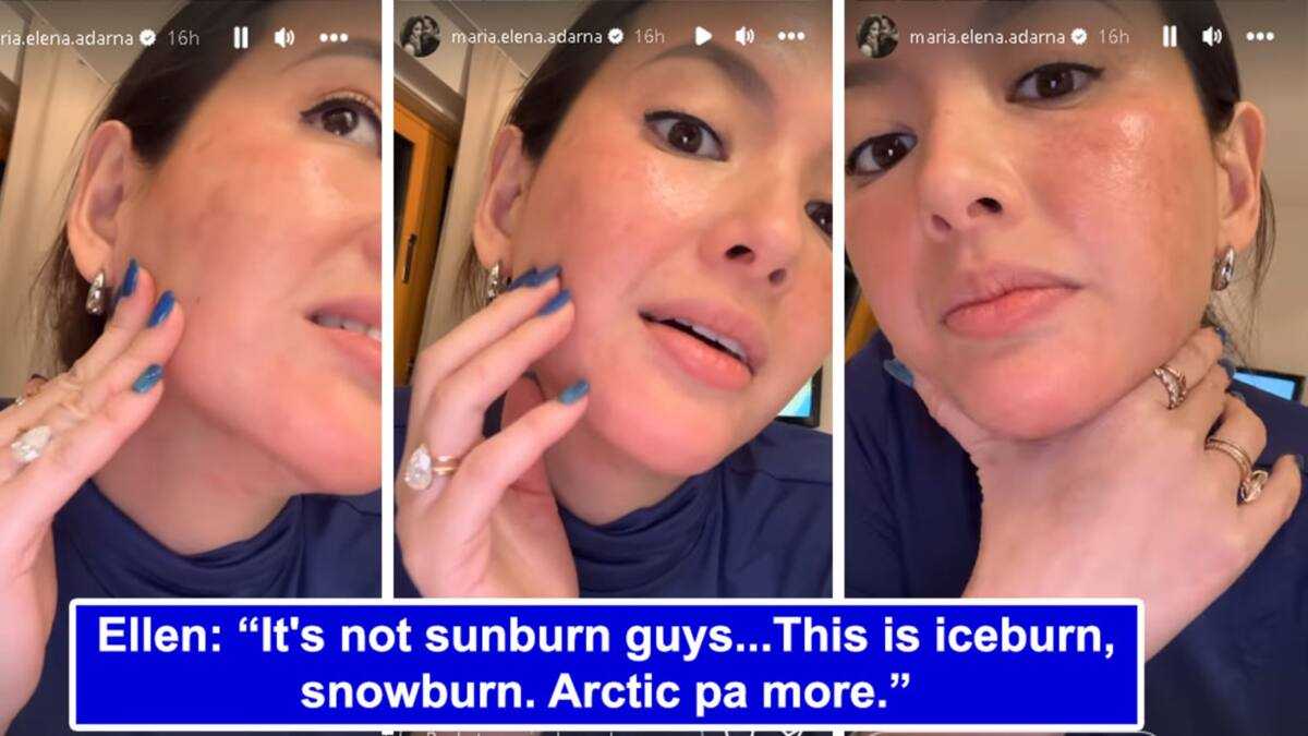 Ellen Adarna, ipinakita ang snow burn na nakuha sa vacay: "Arctic pa ...