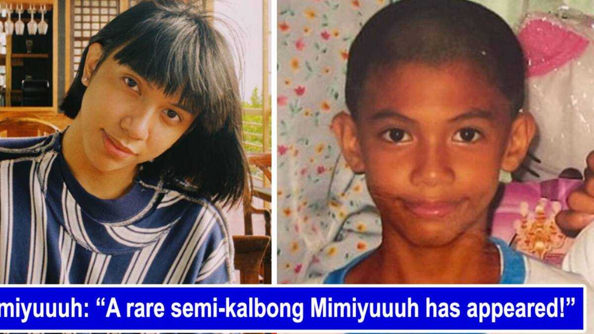 Mimiyuuuh, finlex "semi-kalbo" look noong kabataan pa niya - KAMI.COM.PH