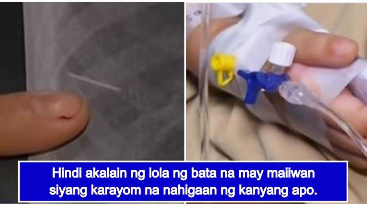 Karayom, tumagos sa katawan ng 6-anyos na bata, halos pumasok na sa ...