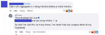 Chloe San Jose, sinagot ang netizen na nagsabing nagpa-retoke siya - KAMI.COM.PH