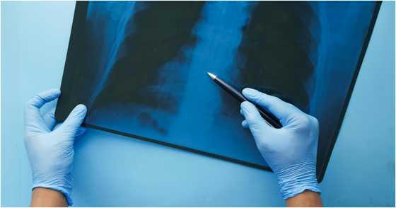 44-anyos na lalaki, nagulantang sa nadiskubreng nakatarak sa kanyang ...