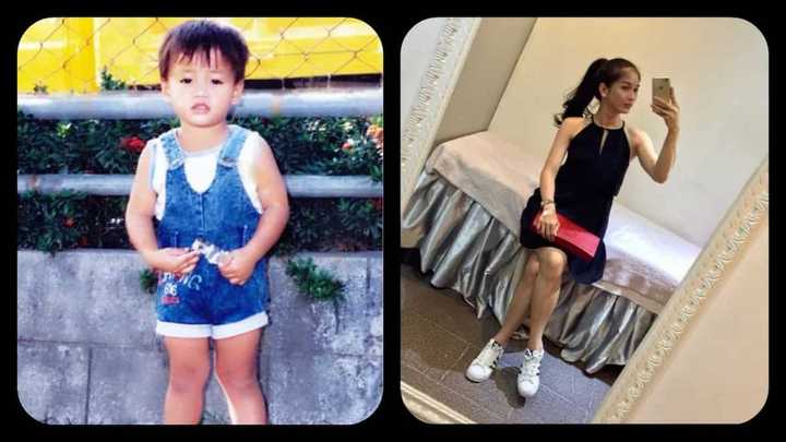 6 Remarkable Pinoy transgender before and after surgery - KAMI.COM.PH