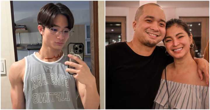 Angel Locsin posts about Joaquin Arce’s disability: “please forgive him ...