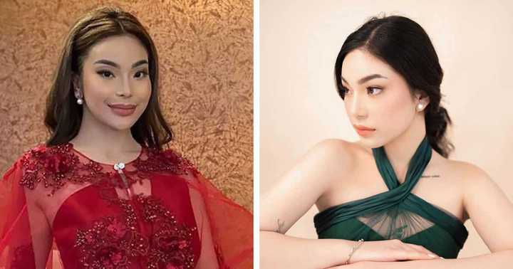 Kitty Duterte reveals getting cosmetic surgery: “Got a rhinoplasty. I ...