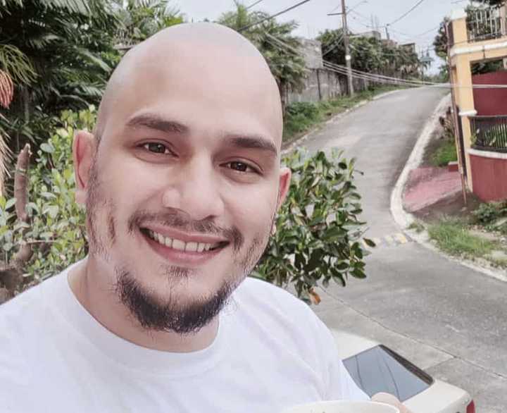 Kiko Matos: "Di bale ng walang buhok basta may FB" - KAMI.COM.PH
